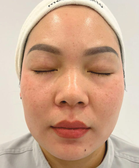 Korean Glass Skin - L'Amour Skin Clinic
